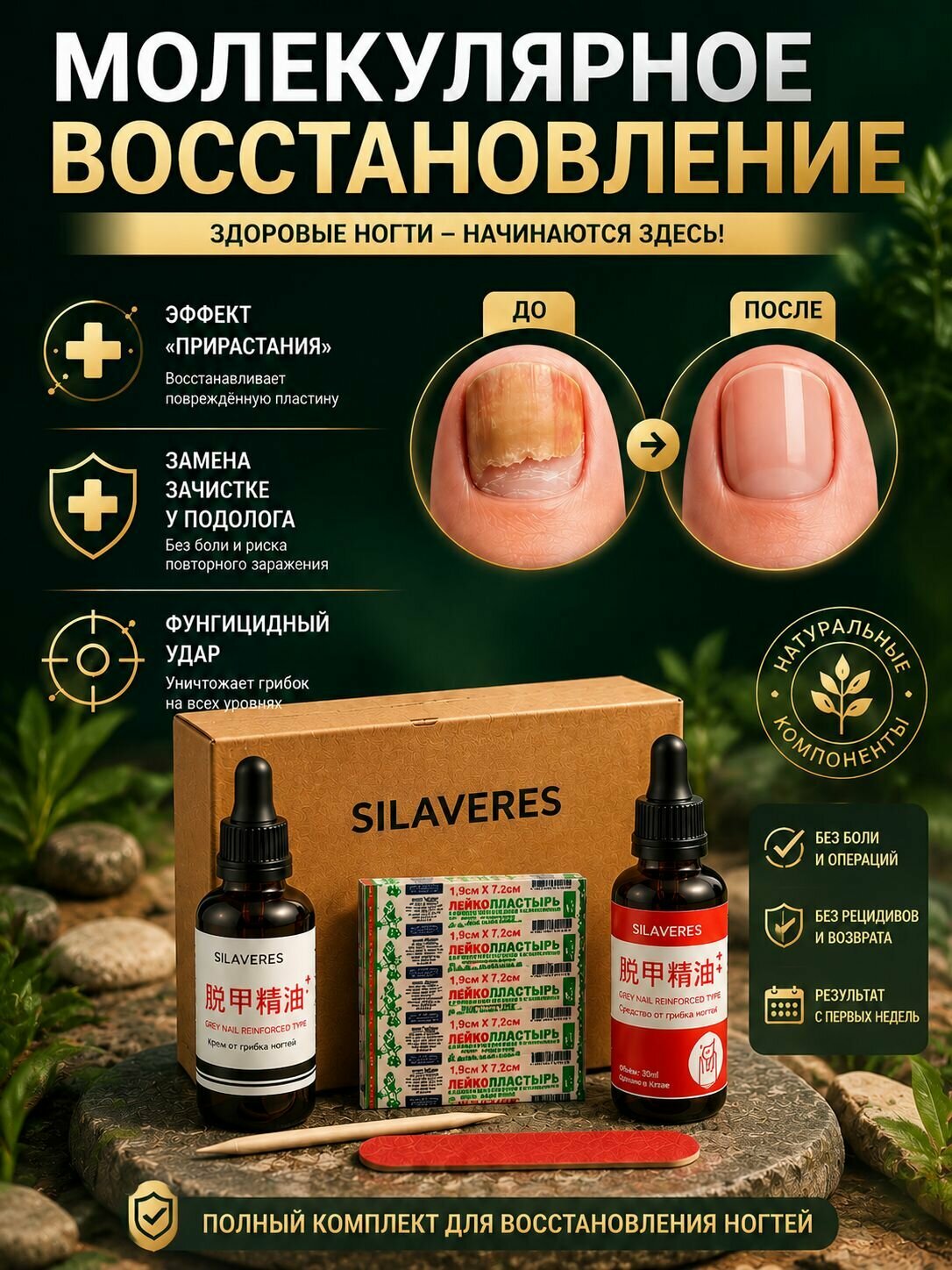 Молекулярный набор от грибка ногтей и онихолизиса SilaVeRes 5в1, масло монарды и крем для восстановления ногтевой пластины восстановление ногтей средство от грибка лечение онихолизиса
