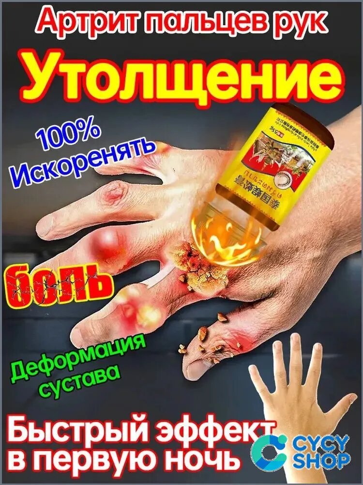 Мазь от подагры, Устранение боли при артрите, коленях, пальцах ног и т. д, на ноге и для рук и артрита 55 г