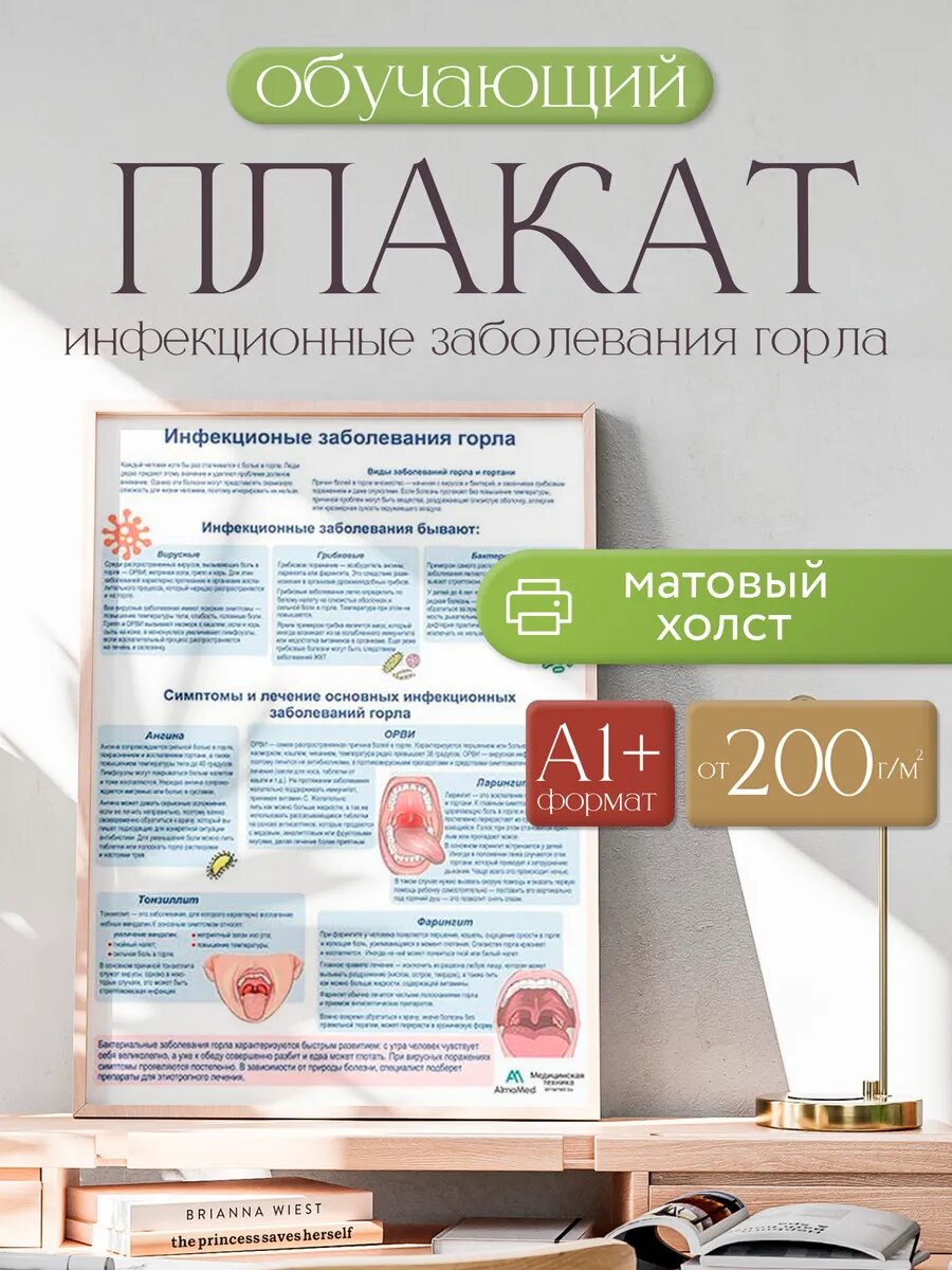 Инфекционные заболевания горла медицинский плакат, матовый холст от 200 г/кв. м, размер A1+