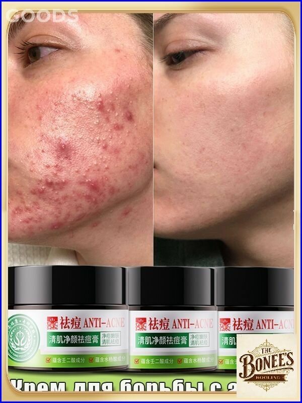 Эксклюзивный крем для ухода за кожей