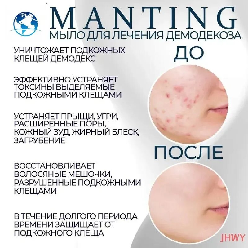 Твердое мыло — фото 1