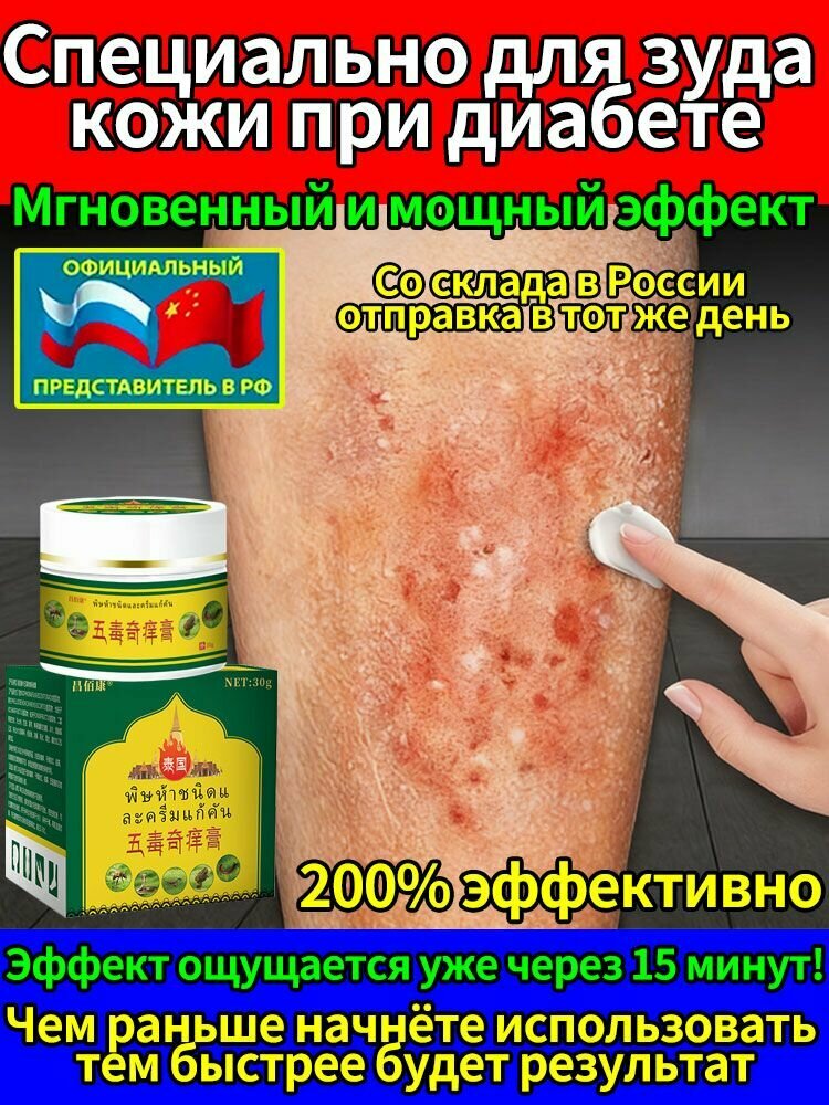 Мазь от кожного зуда, вызванного диабетом