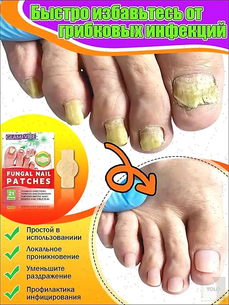 Лечебные пластыри от онихомикоза рук и ног, подавляющие рост грибков, улучшающие состояние при паронихии, стимулирующие рост ногтей, а также используемые в маникюре и уходе за ногтями.