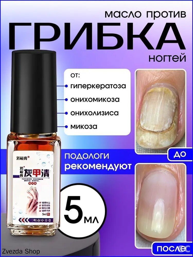 Масло от грибка ногтей 5 мл лечение онихолизиса