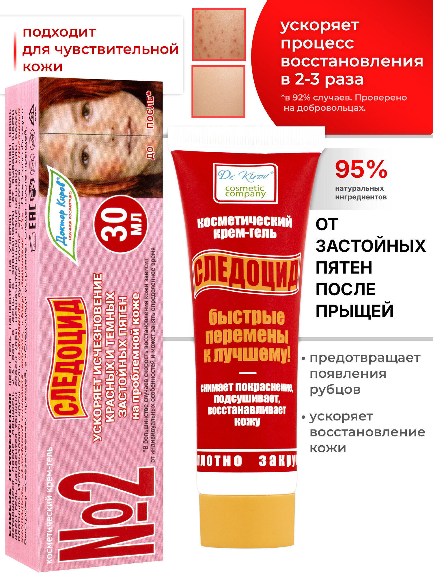 Крем от постакне, следов от прыщей для проблемной кожи "Следоцид", 30 мл. /Доктор Киров
