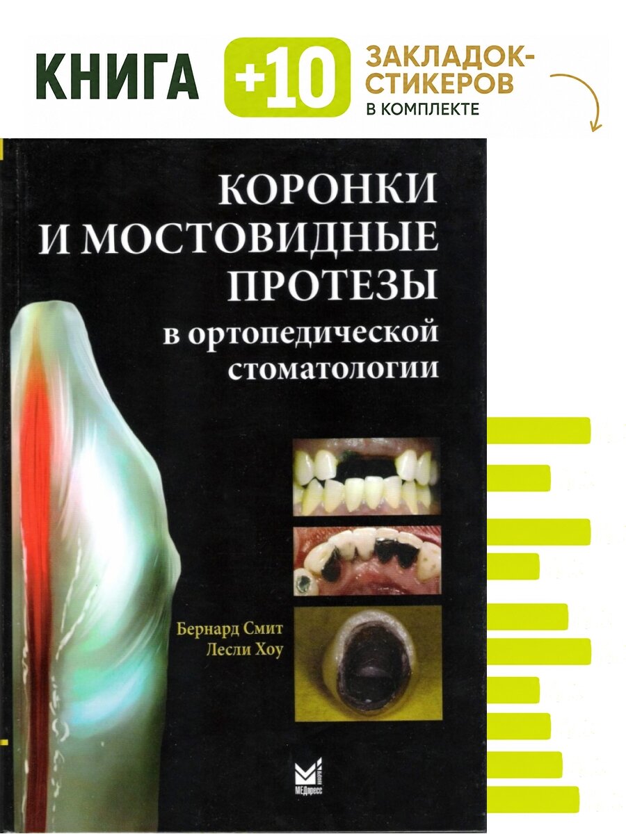 Коронки и мостовидные протезы в ортопедической стоматологии. Комплект: книга + 10 закладок-стикеров