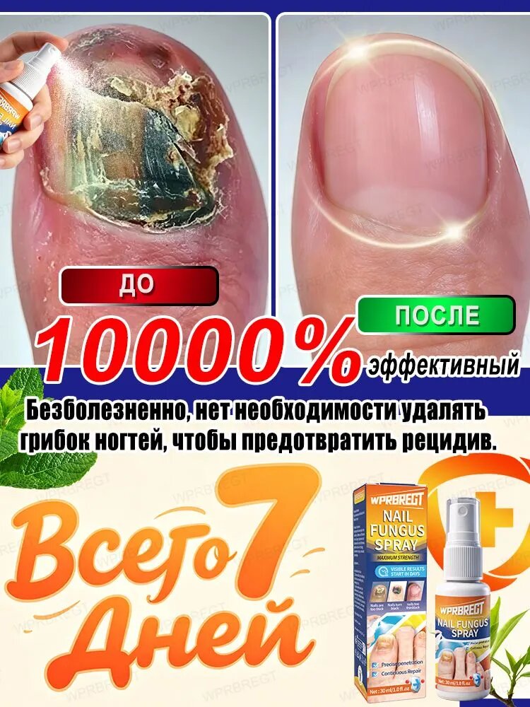 Спрей от грибка ногтей эффективное лечение онихомикоза, быстрое удаление грибка на ногах и руках.