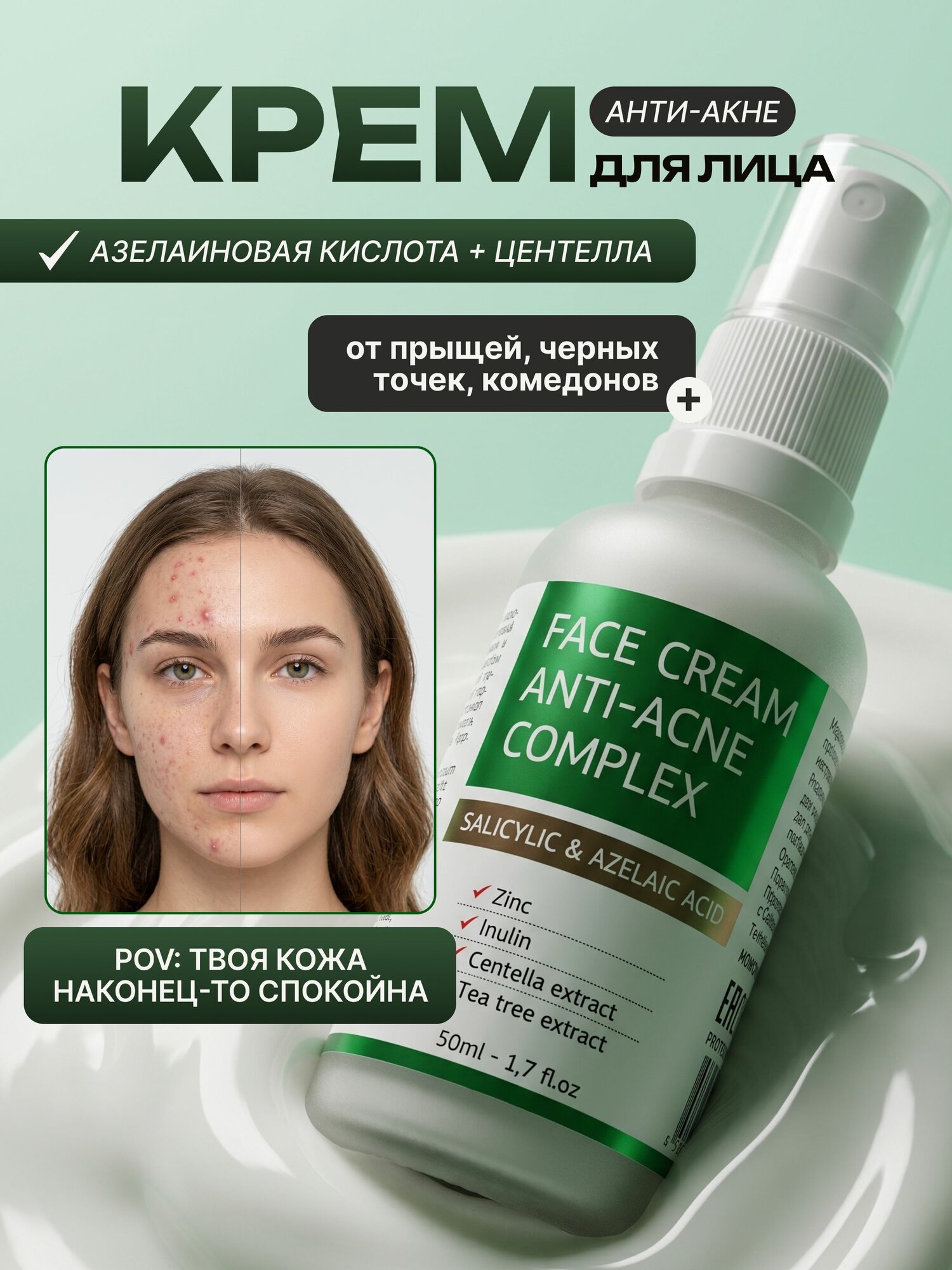 Крем для лица от прыщей и чёрных точек Матирующий + противовоспалительный 50 мл