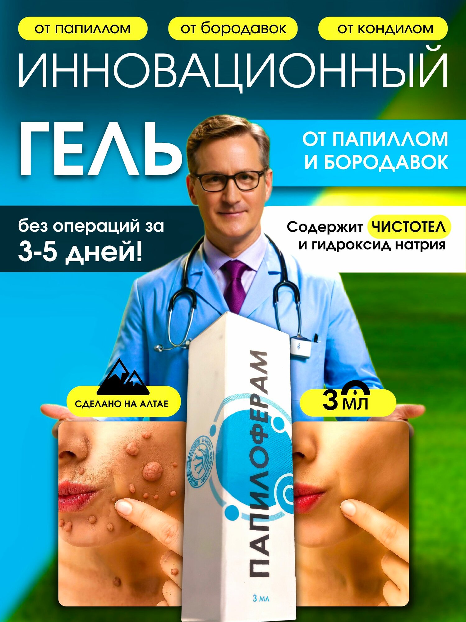 Гель от бородавок и папиллом чистотел