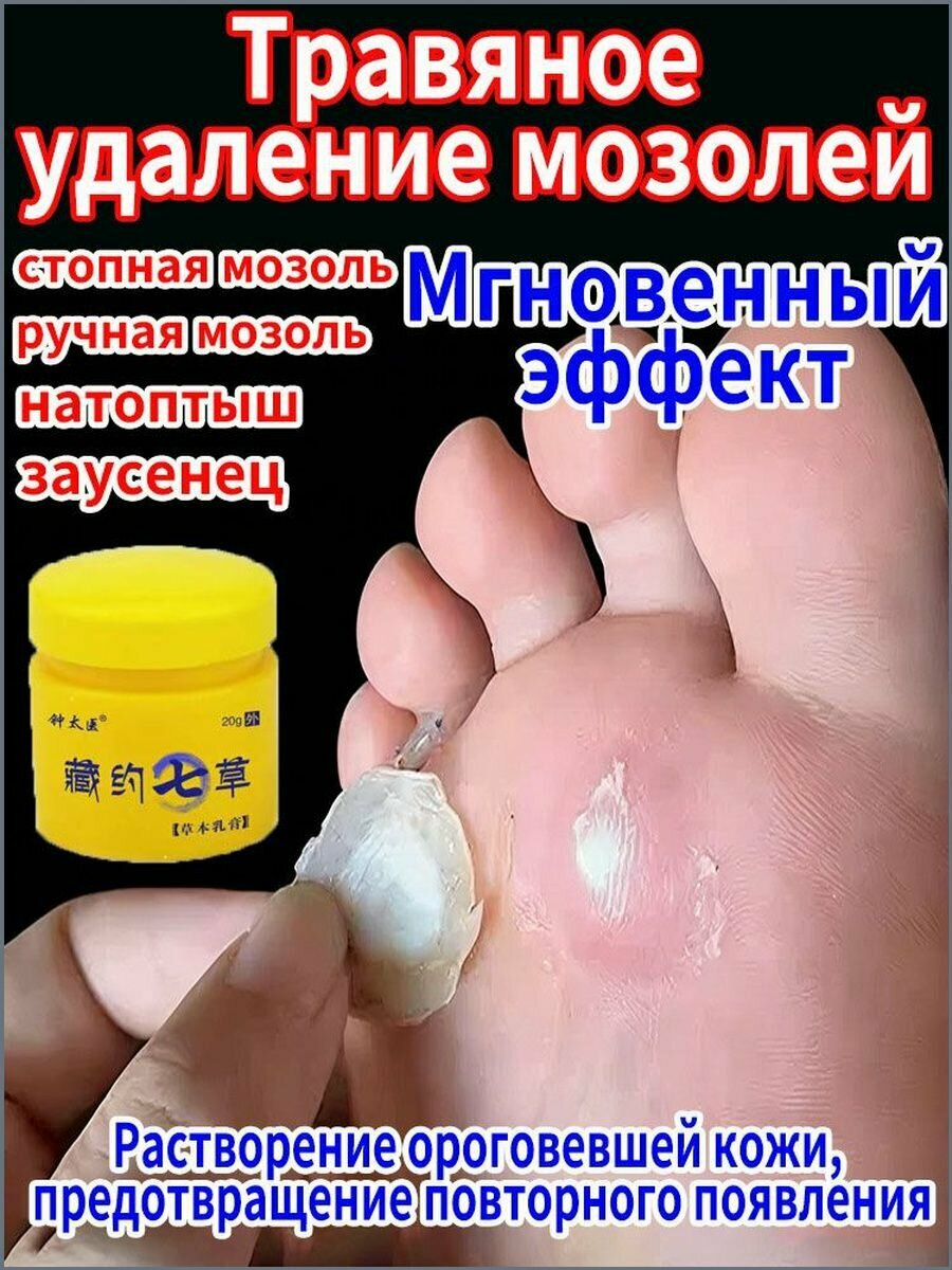 Эффективный крем для быстрого избавления бородавок, мозольный удаления мозолей, натоптышей, средство от шипиц на ногах, китайская чудо мазь 20 г от мазолей и надоптвшей, колломак от бородавок