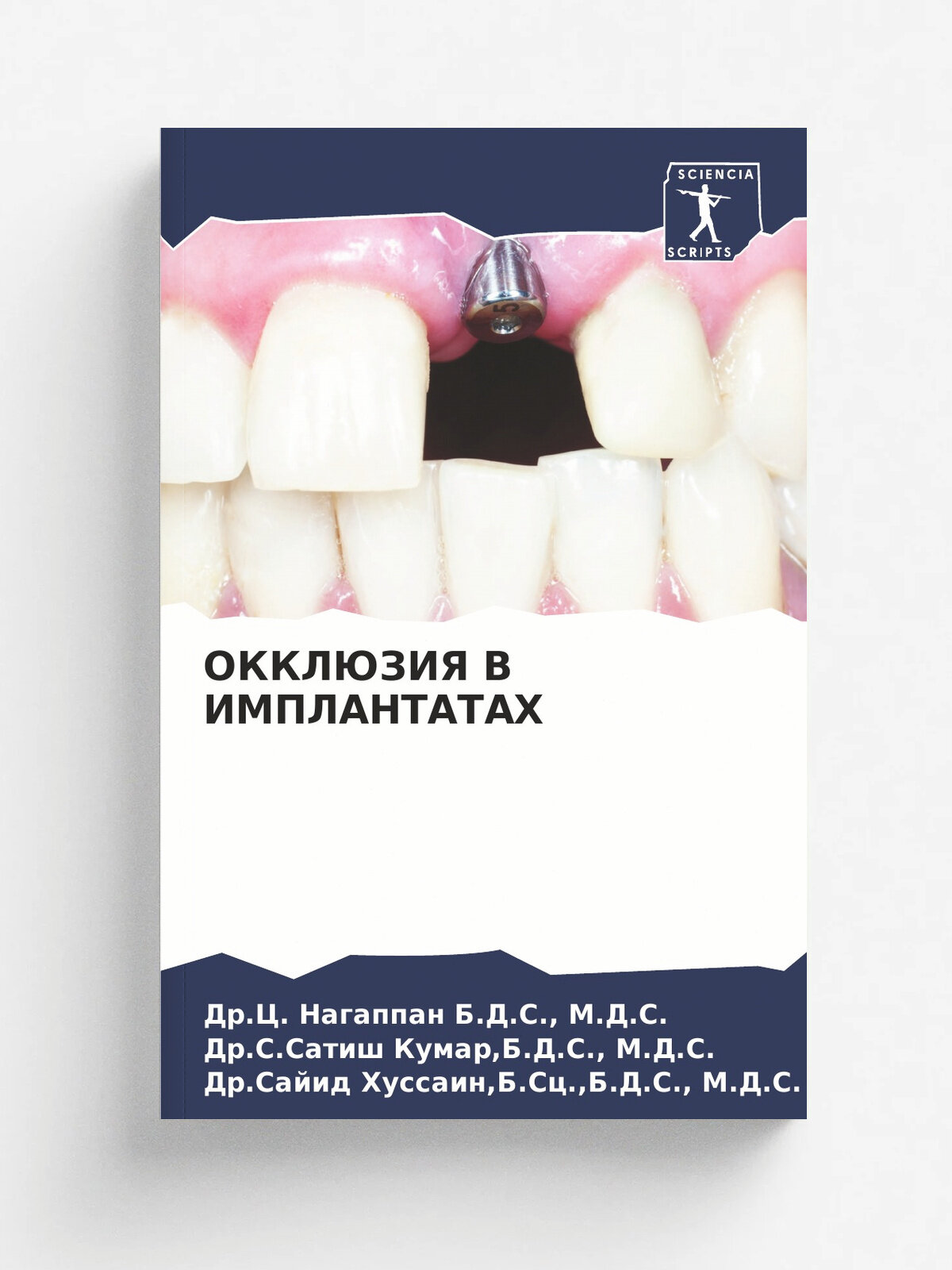 Окклюзия В Имплантатах | М. Д. С. Др. Ц. Нага Б. Д. С. | KS OmniScriptum Publishing, 2021