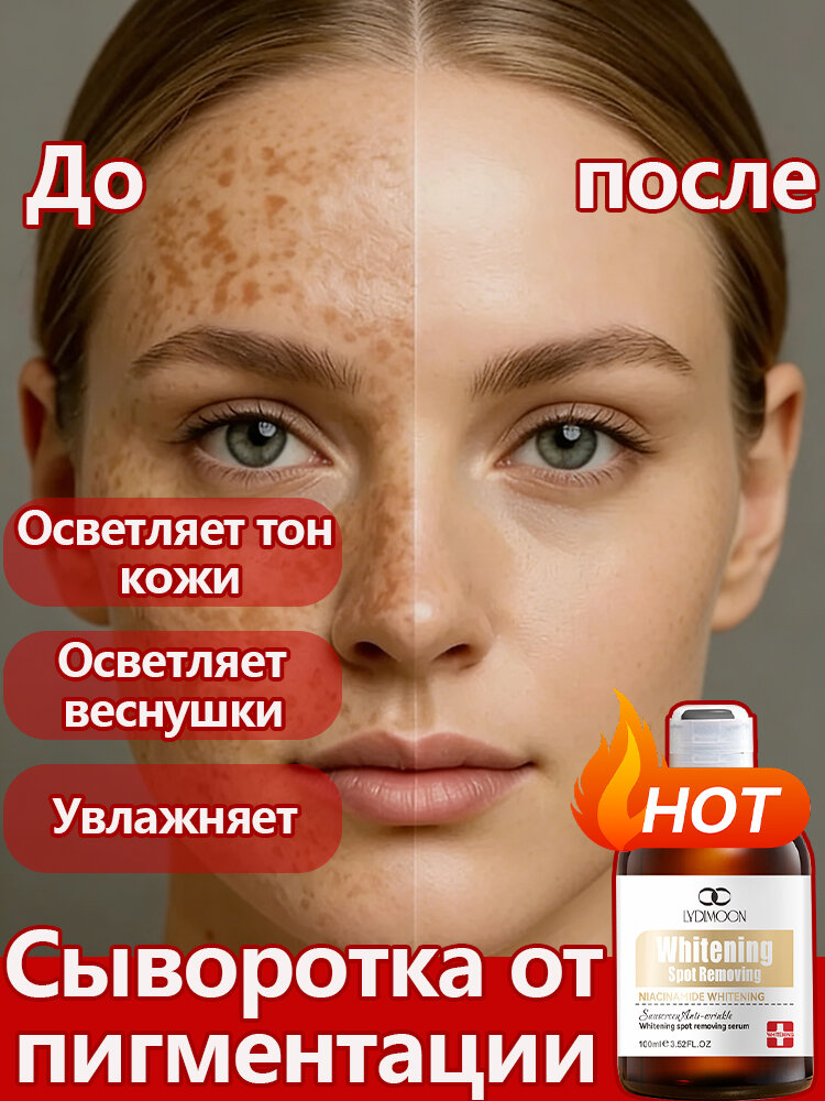 LYDIMOONсыворотка для отбеливания лица сыворотка от пигментации для лица от веснушек и пигментных пятен, осветление кожи 100 мл