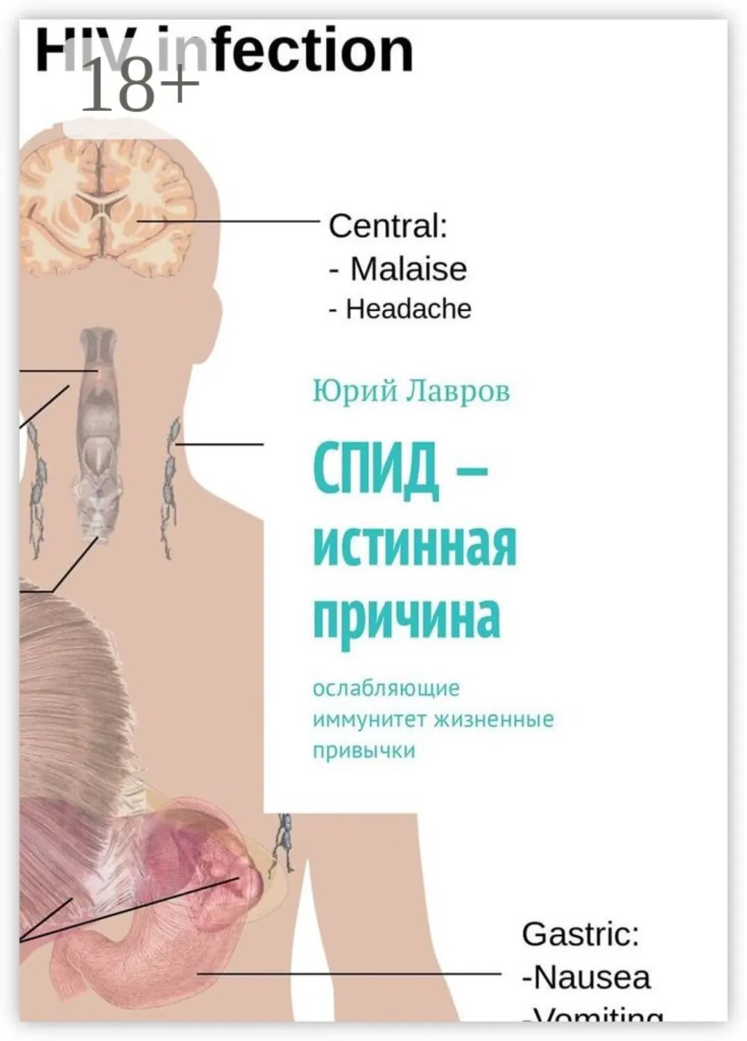 СПИД – истинная причина. Ослабляющие иммунитет жизненные привычки [Цифровая книга]