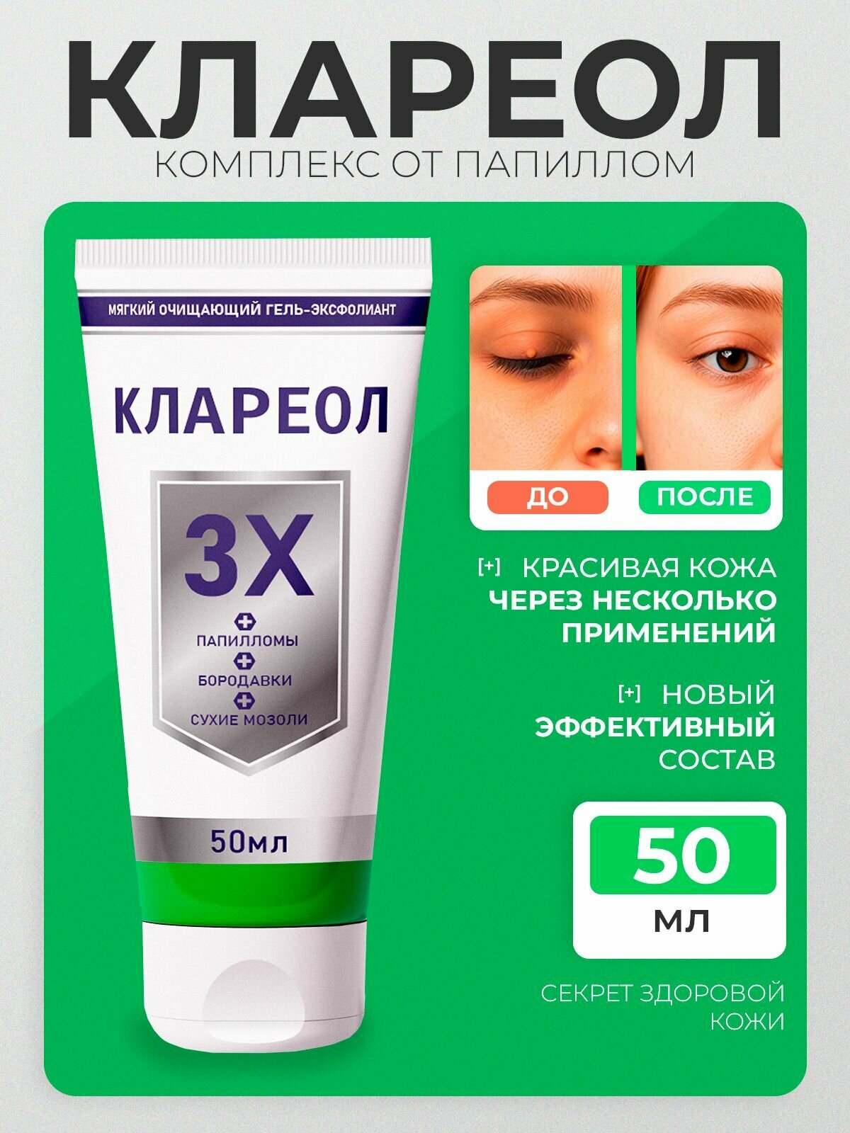 Клареол: крем для удаления папиллом и бородавок