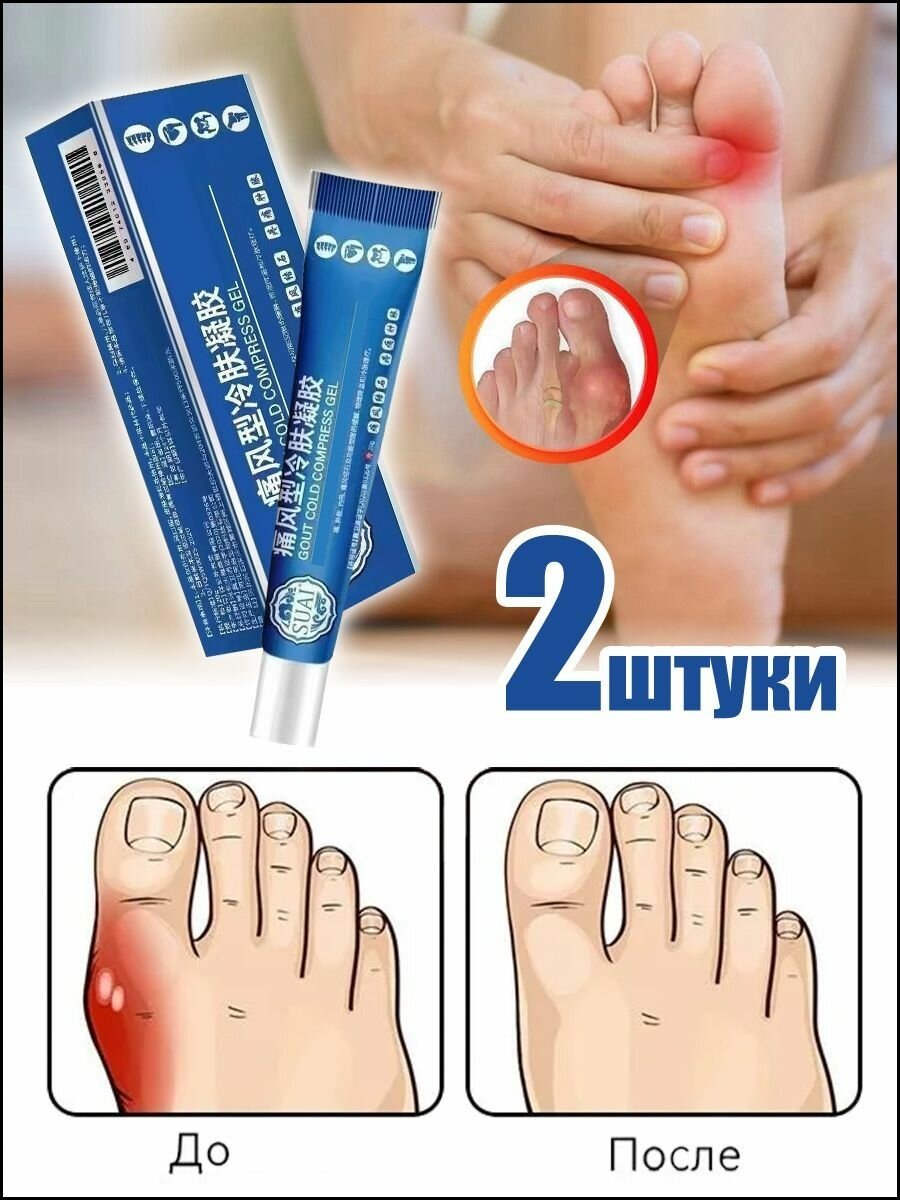 Мазь от подагры и артрита, обезболивающая мазь, 20 г