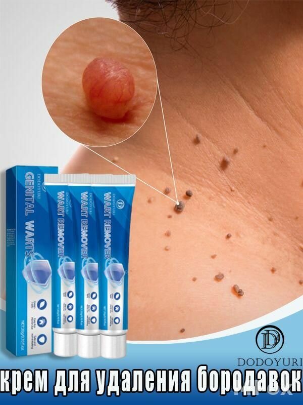 Эффективно лечит родинки, папилломы и разные виды бородавок / Средство от папиллом и бородавок DODOYURI гель ./ 60г
