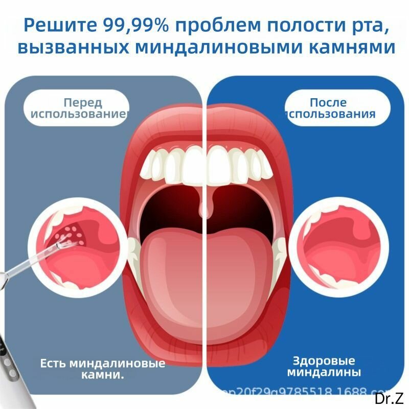 Вакуумный аппарат для чистки миндалин и удаления камней, ирригатор от пробок в горле и запаха изо рта, 3 режима