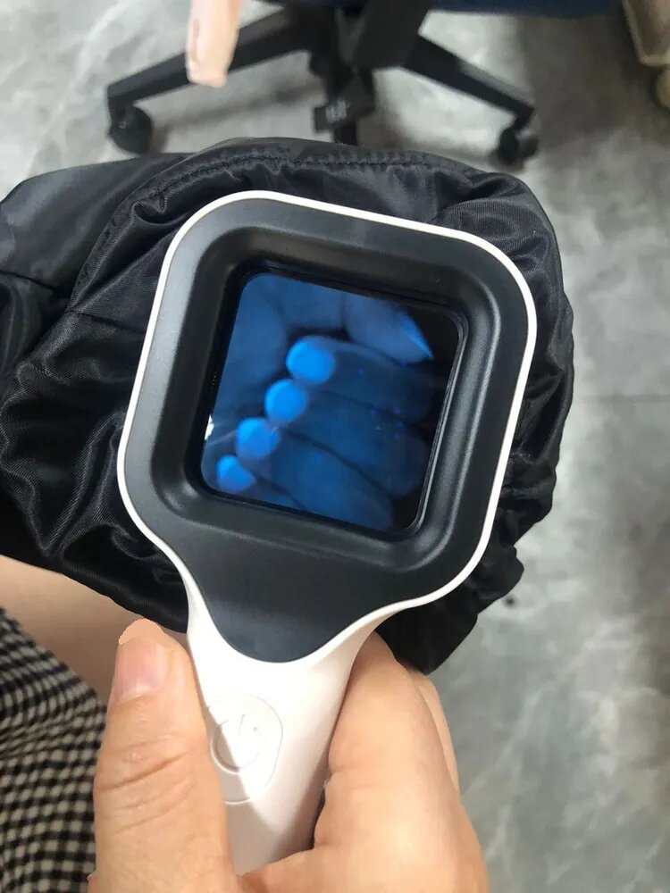 Диагностическая лампа Вуда для кожи и ветеринарии УФ-лампа 365 нм