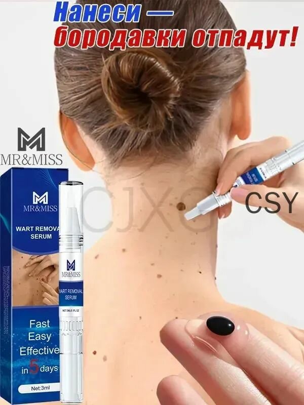 /Эссенция для удаления бородавок, папиллом и родинок, безболезненно, без шрамов и побочных эффектов.