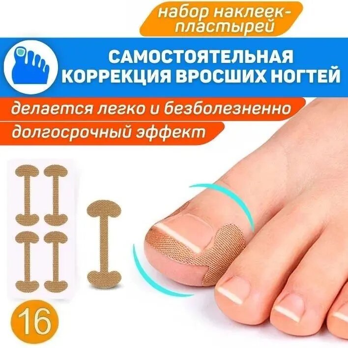 Набор наклеек для коррекции вросших ногтей / Пластырь для исправления пластины при онихокриптозе / Педикюрная корректирующая система для приподнимания ногтя на ноге - 16 шт.