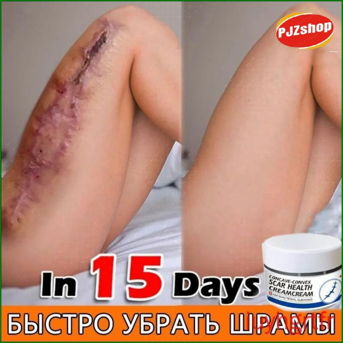 Эксклюзивный кремгель для коррекции шрамов, рубцов, растяжек и пигментных пятен на теле, включая последствия акне и травм-Новая продукция