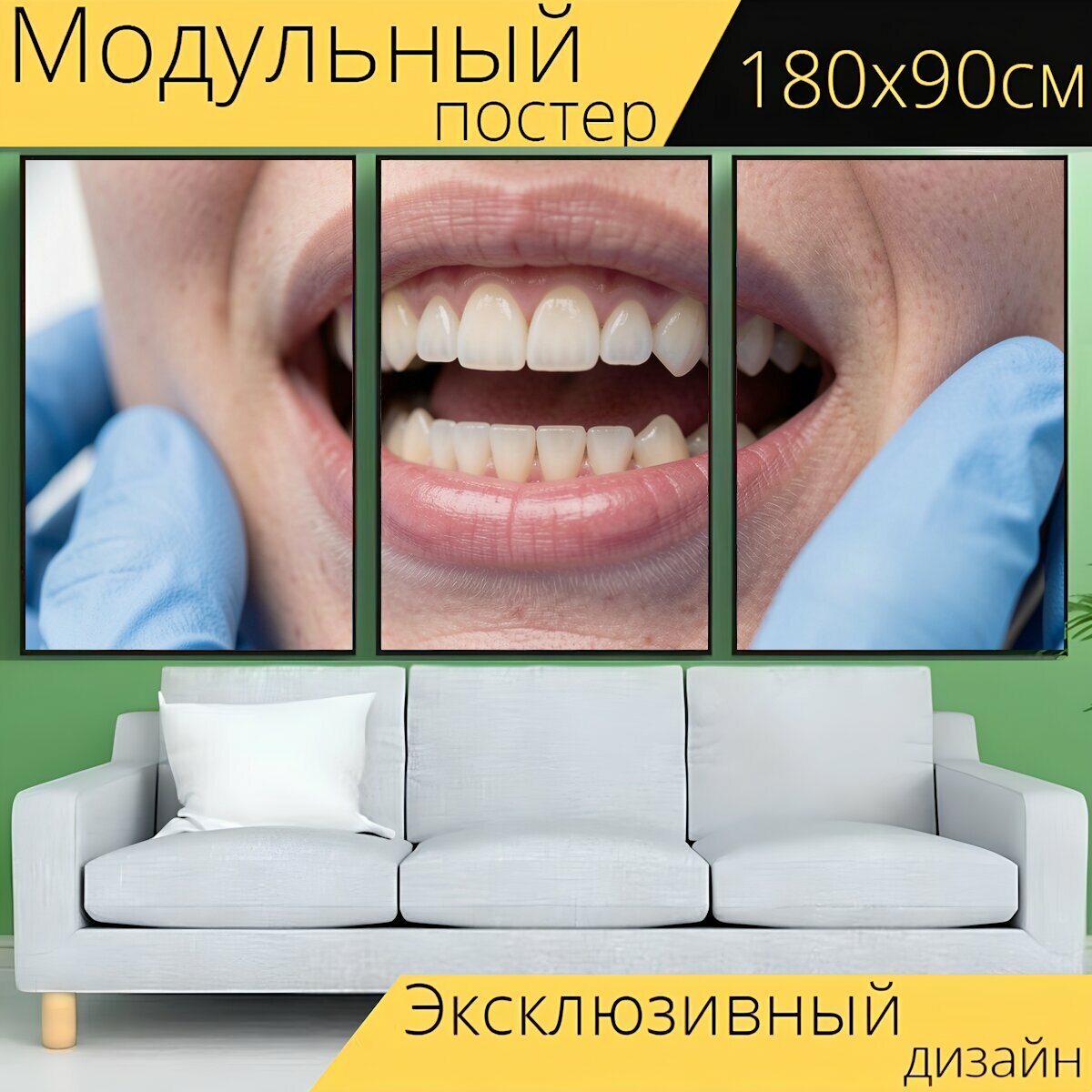 Модульный постер "Крупный план рта человека с открытыми зубами, стоматолог в синих перчатках, мягкое рассеянное освещение." 180 x 90 см. для интерьера на стену в тубусе