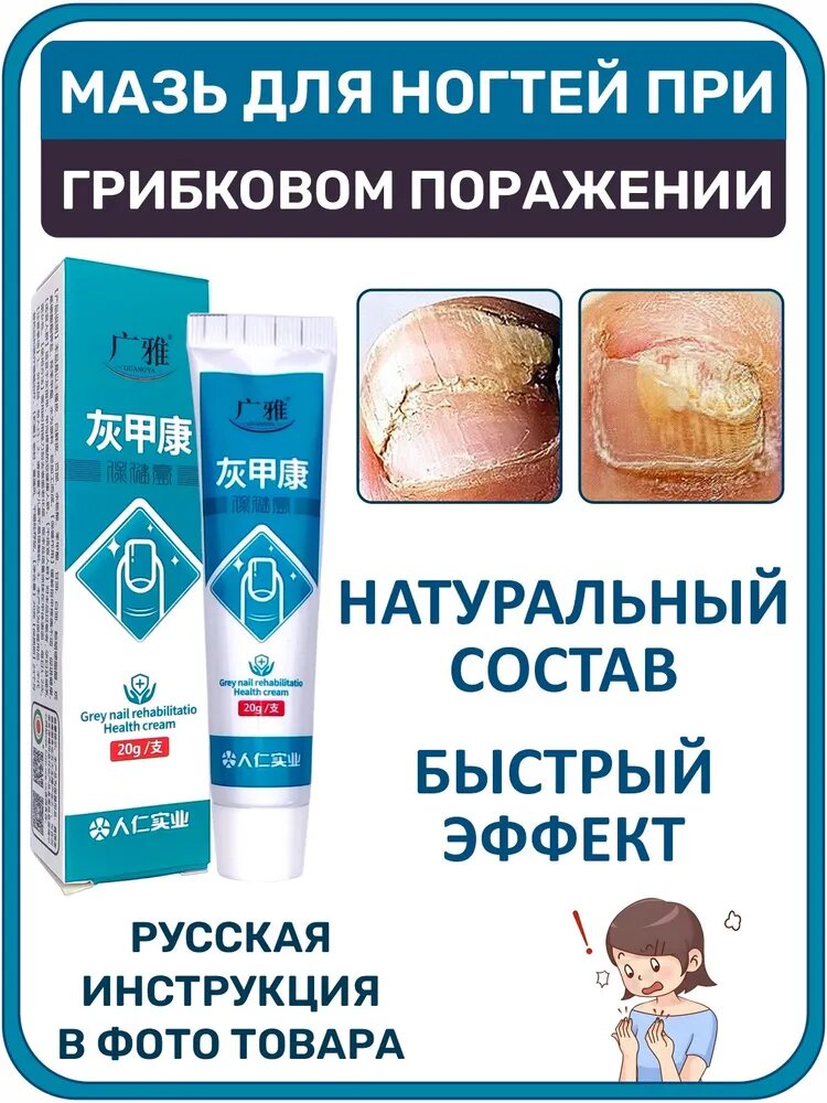 Средство для ногтей при грибковом поражении на руках и ногах
