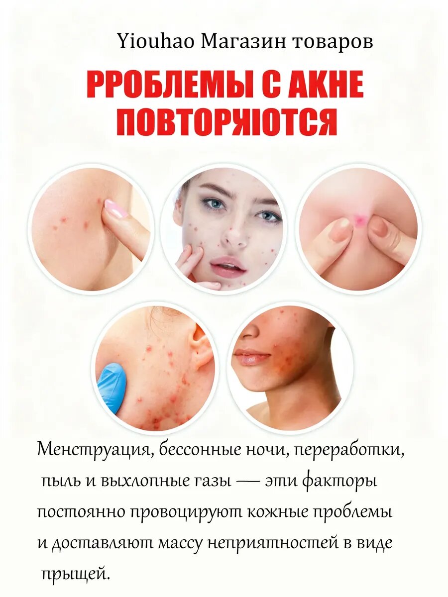 Патчи от прыщей в форме сердца — фото 1