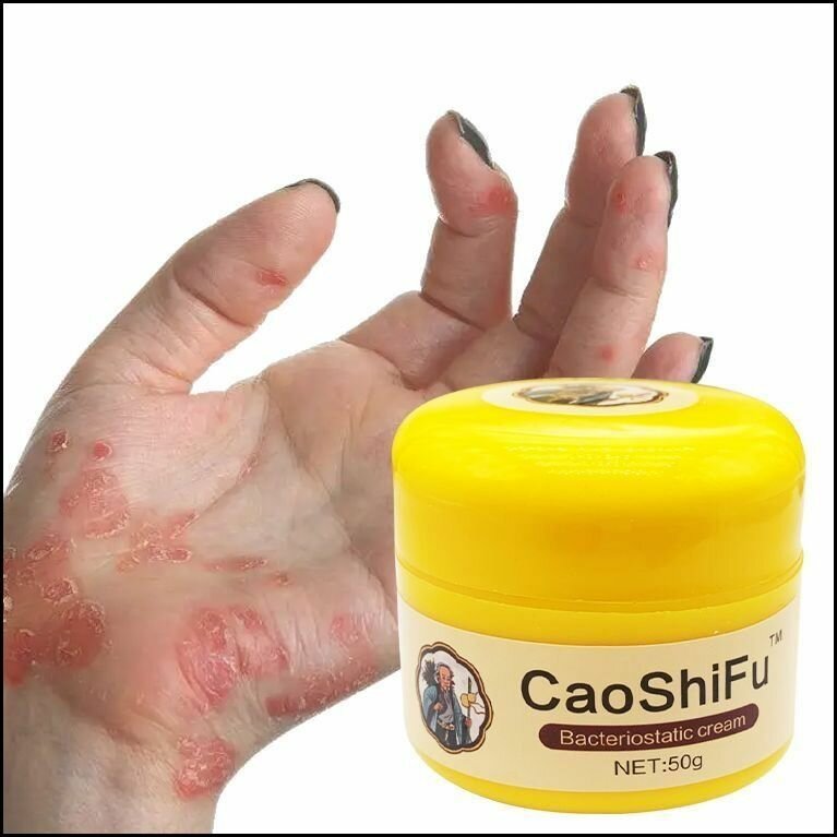CAOSHIFU Антибактериальный крем для кожи, 50 г, большая емкость. Мазь от псориаза, дерматита, зуда кожи и экземы, для проблемной кожи на теле.