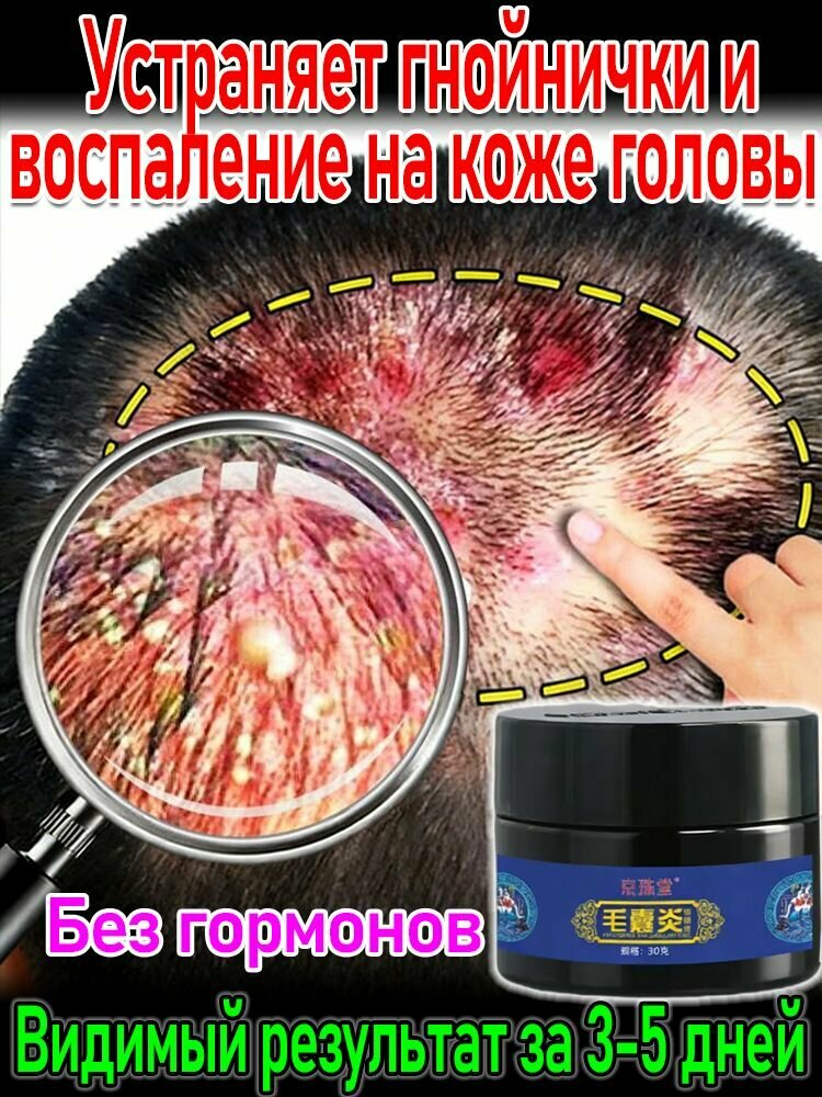 Мазь от жировика на голове