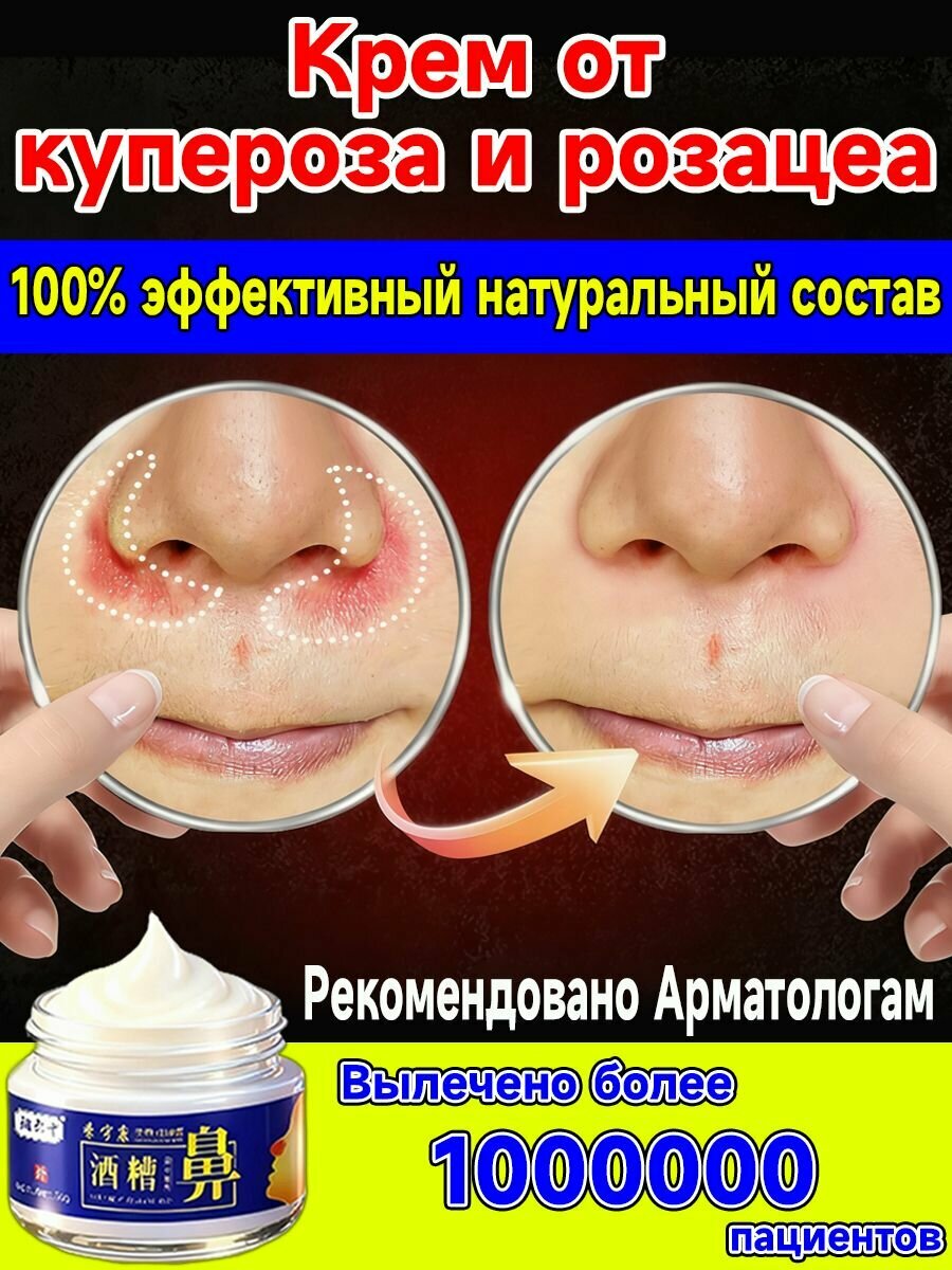 Гельтек Гель Демотен от прыщей акне демодекоза розацеа для проблемной и жирной кожи лица 30r