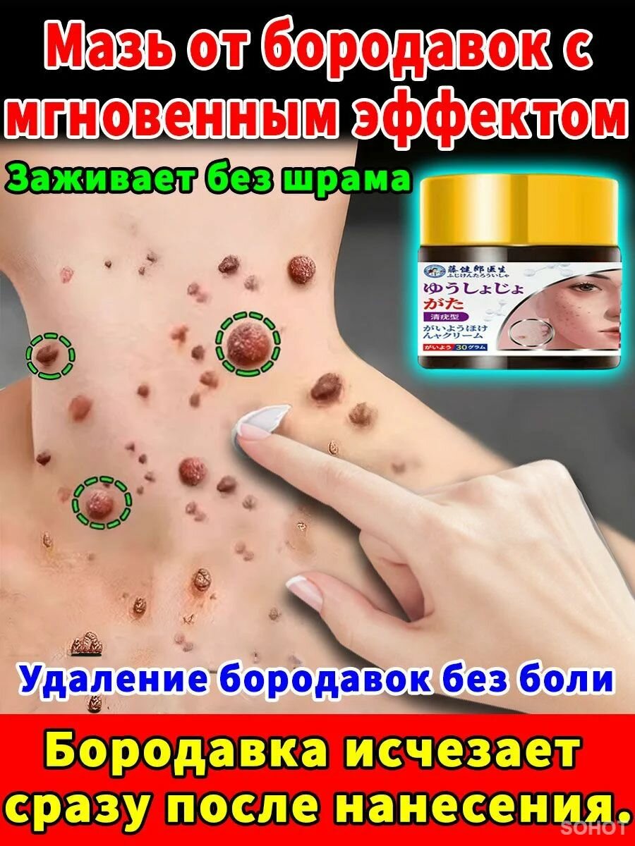 Крем для удаления бородавок и родинок, на основе натуральных растительных компонентов, 30 мл