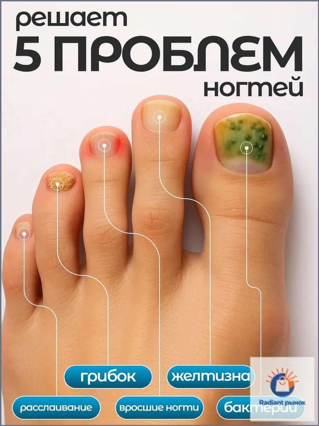 Премиальное средство от грибка ногтей Nail Fungus, 10 мл, применяется для терапии онихолизиса.