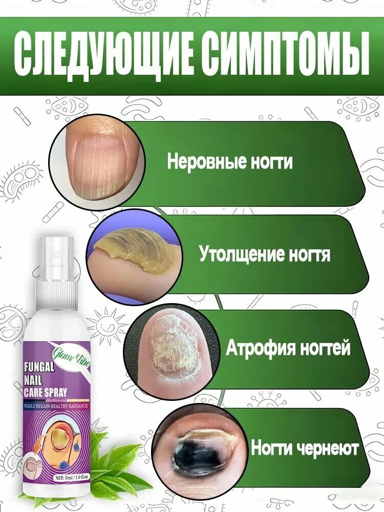 Спрей для лечения, укрепления и восстановления грибковых инфекций ногтей на ногах и ногтях на руках. Лечит онихомикоз, подавляет рост грибков и способствует здоровому росту ногтей. 150 мл