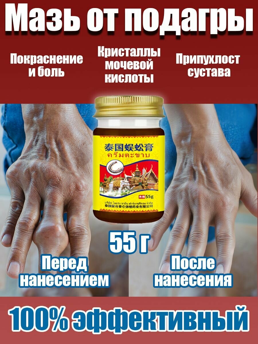 Мазь от подагры, Устранение боли при артрите, коленях, пальцах ног и т. д, на ноге и для рук и артрита 55 г