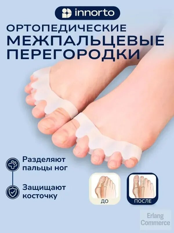 Разделители пальцев ног силиконовые. Межпальцевые перегородки ортопедические, цвет белый