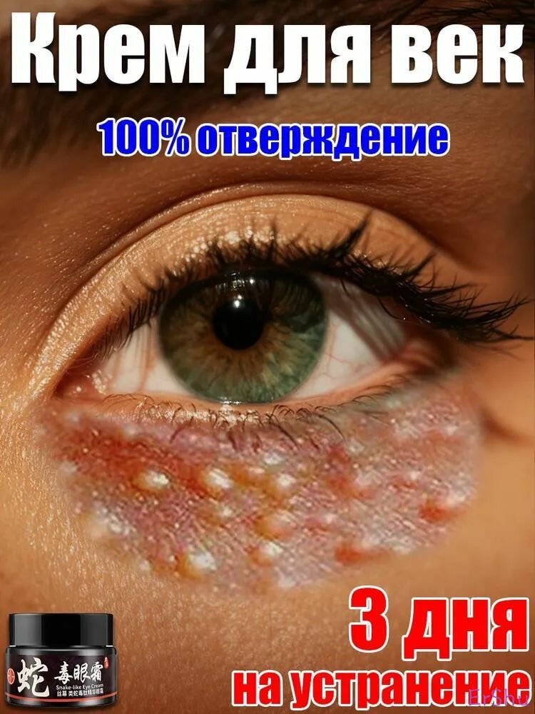 Средство от милиумов на лице, ретидерм крем для век антивозрастной, натуральный крем для удаления липомы Быстро удаляет подкожную липому, показан при отечности кожи, целлюлите, фиброзном жировике