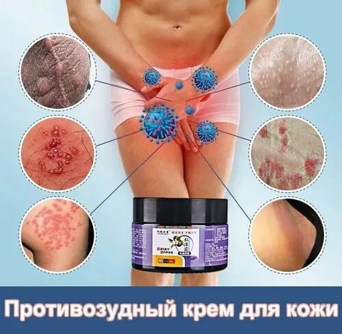 Успокаивающий крем-гель от зуда, воспаления и раздражения в интимных местах 30 г