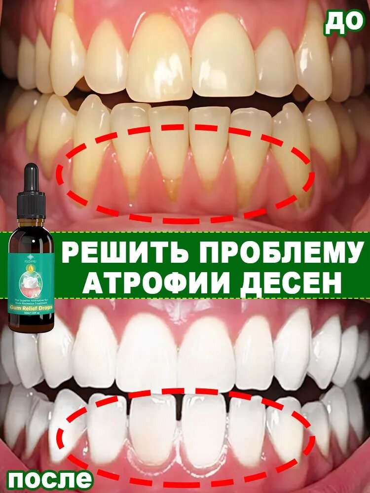 Эфирные масла для ухода за полостью рта при атрофии десен, чувствительности зубов, стоматите и уходе за деснами. Растительные экстракты. Антибактериальные средства по уходу за полостью рта.30 мл
