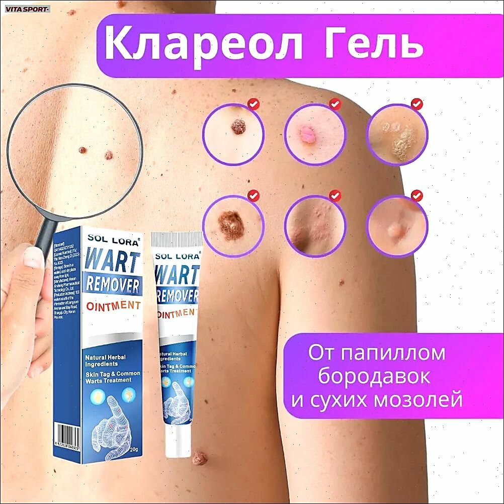 Средство от папиллом и бородавок, мазь для ухода за кожей, крем от родинок, Натуральные растительные ингредиенты
