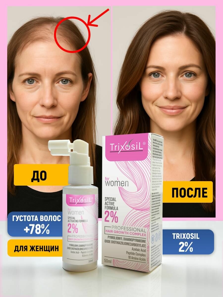 Trixosil 2% Лосьон для роста волос / Усиленная сыворотка от выпадения волос для женщин