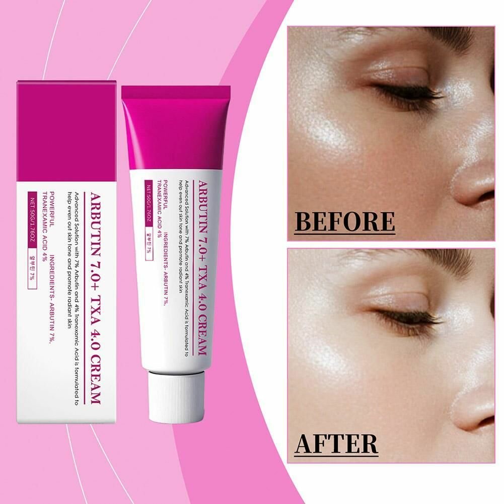 Увлажняющий крем-осветлитель 50 мл с арбутином 7% для борьбы с пигментными пятнами и темными пятнами.