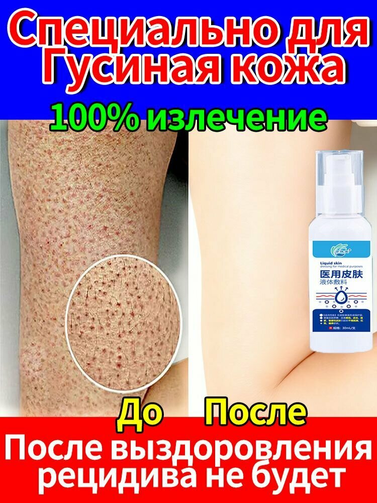 Крем от гусиной кожи для тела
