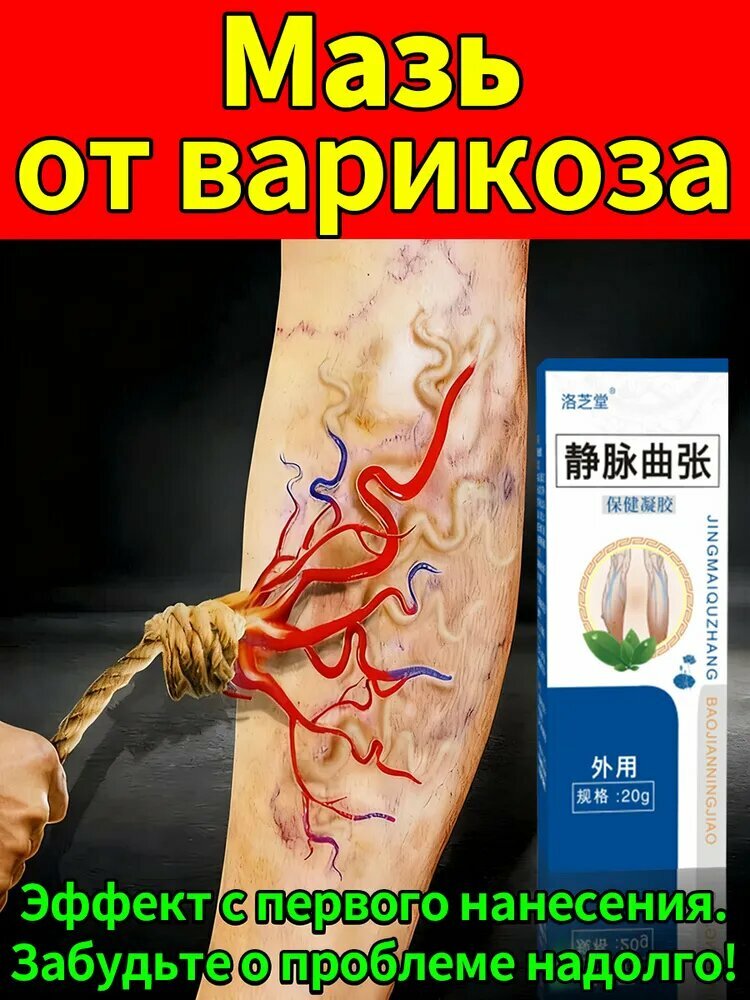 Мазь от варикозного расширения вен эффективно лечит варикозное расширение вен, сосудистые звездочки, тромбоз, усталость, отеки ног и боль.20 г