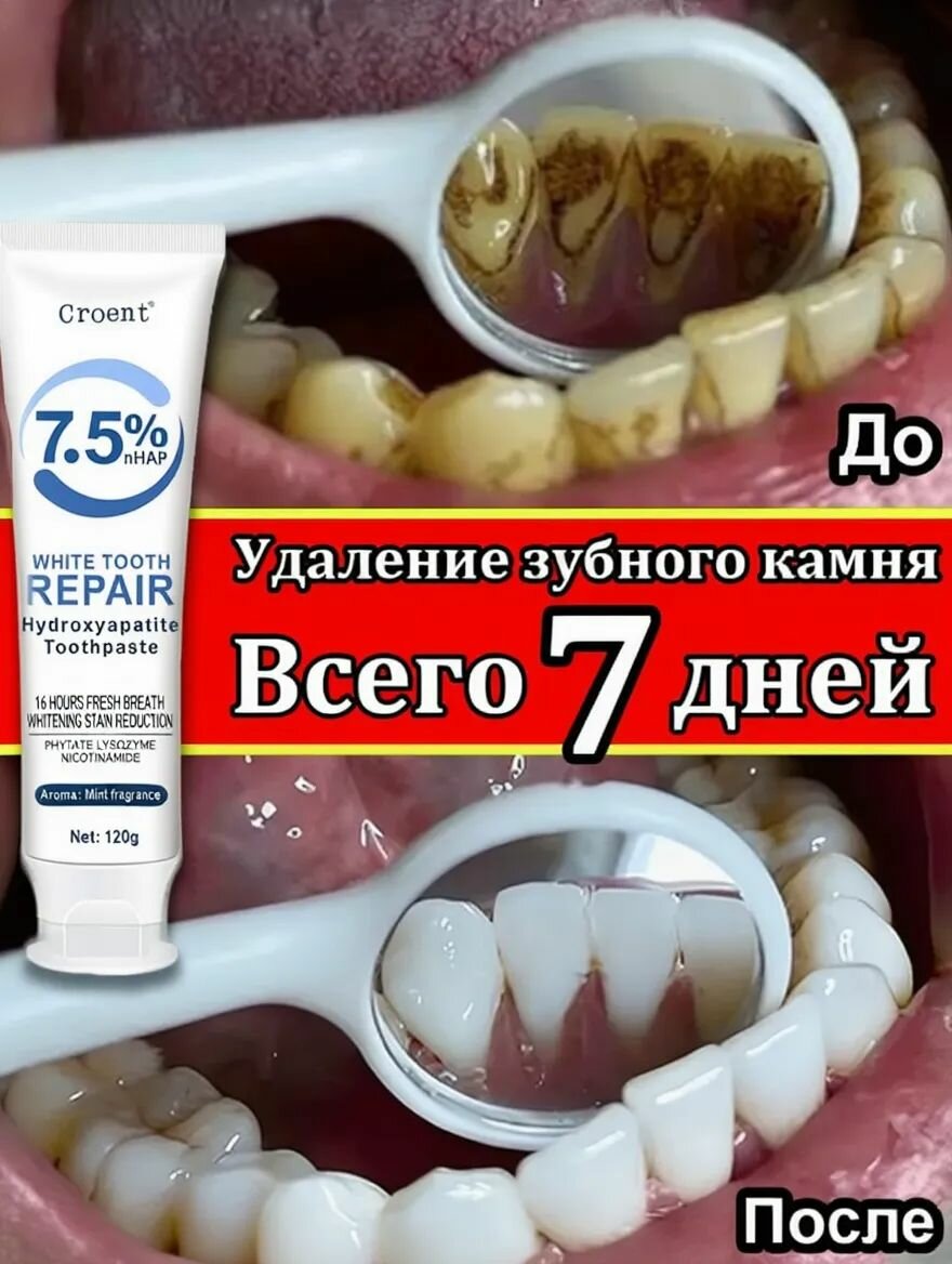 Отбеливающая зубная паста Croent с гидроксиапатитом 7,5%, для чувствительных зубов, 120 г