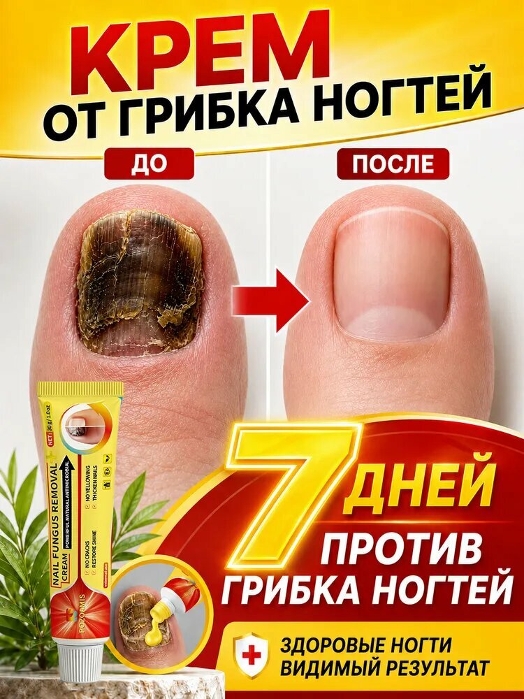 Быстрое устранение грибка ногтей и онихомикоза, лечение грибковых инфекций, укрепление ногтевой пластины, удаление рогового слоя, крем 90 мл