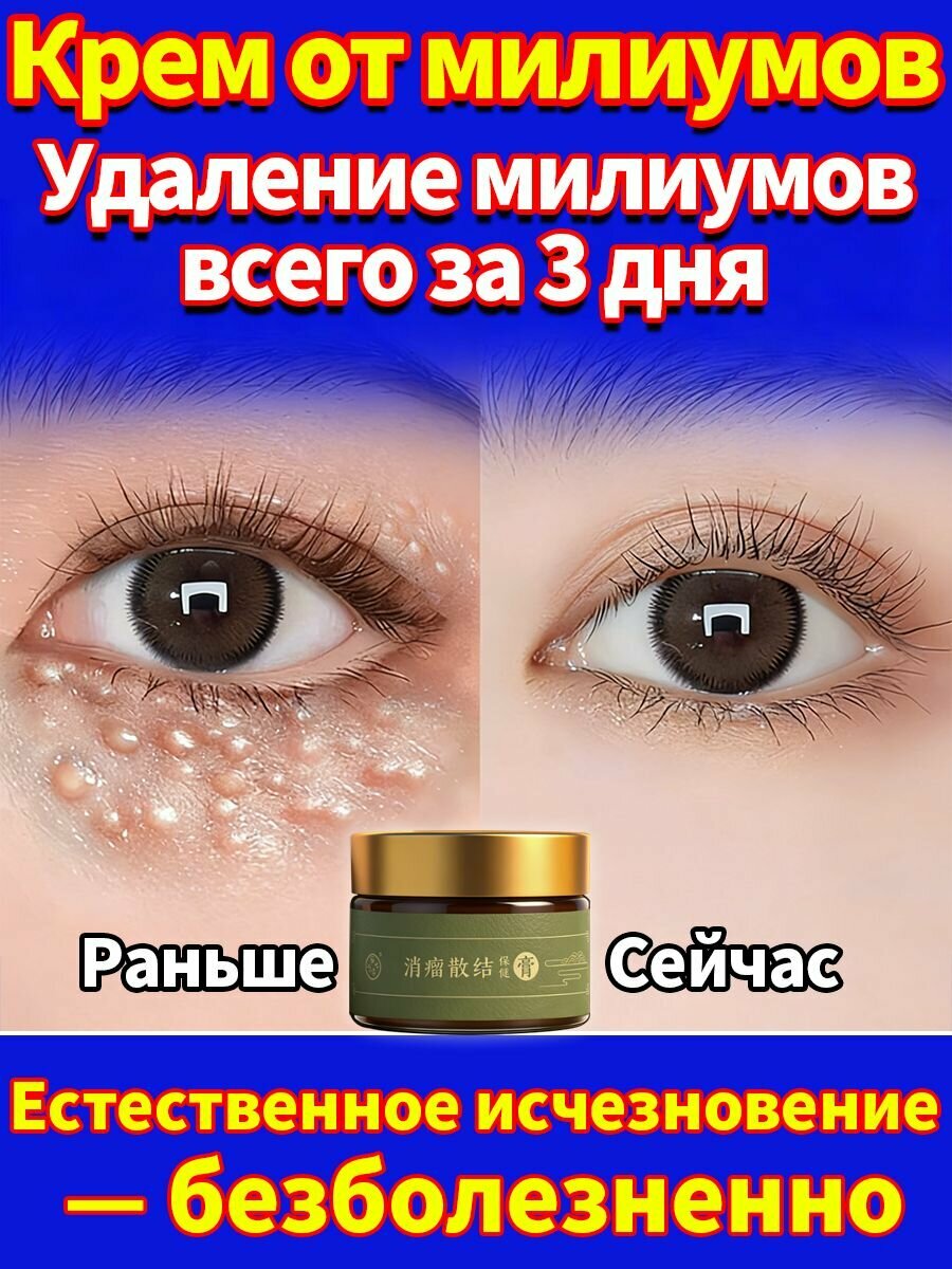 Мазь от милиумов от просянки белых угрей и роговых кист