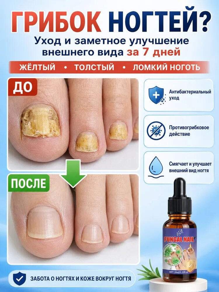 Масло для ногтей и кутикулы, уход при грибке и онихомикозе, восстановление ногтевой пластины, против желтизны и утолщения,10 мл