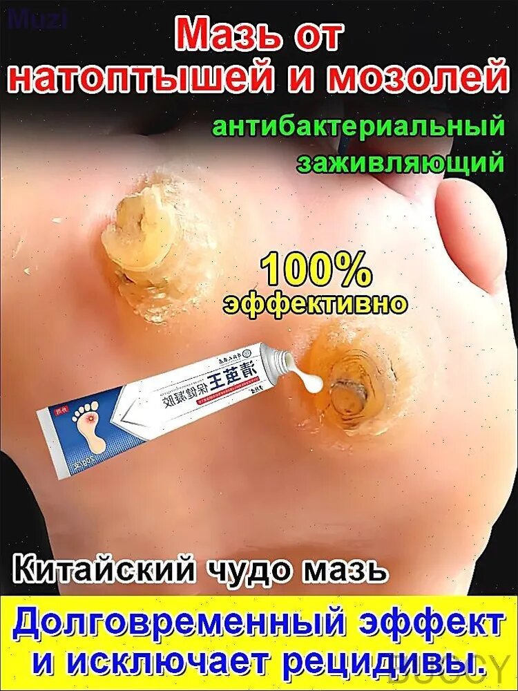 Mазь от мозолей стержневых и натоптышей , Крем от сухих мозолей, шипицы, бородавок, натоптышей,20 г.