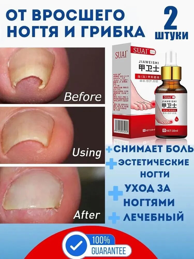 Восстанавливающая сыворотка для ногтей, антибактериальное средство для ухода за ногтями рук и ног, 10 мл, 1 шт